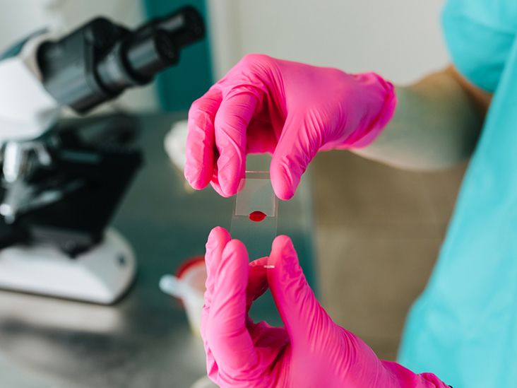 Ham Test: Purpose, Procedure and Results