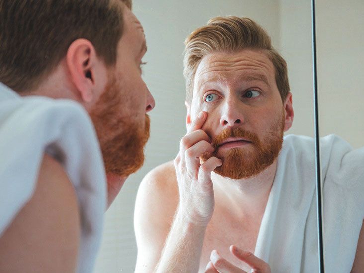 Pus in Eye: Causes and When to See a Doctor