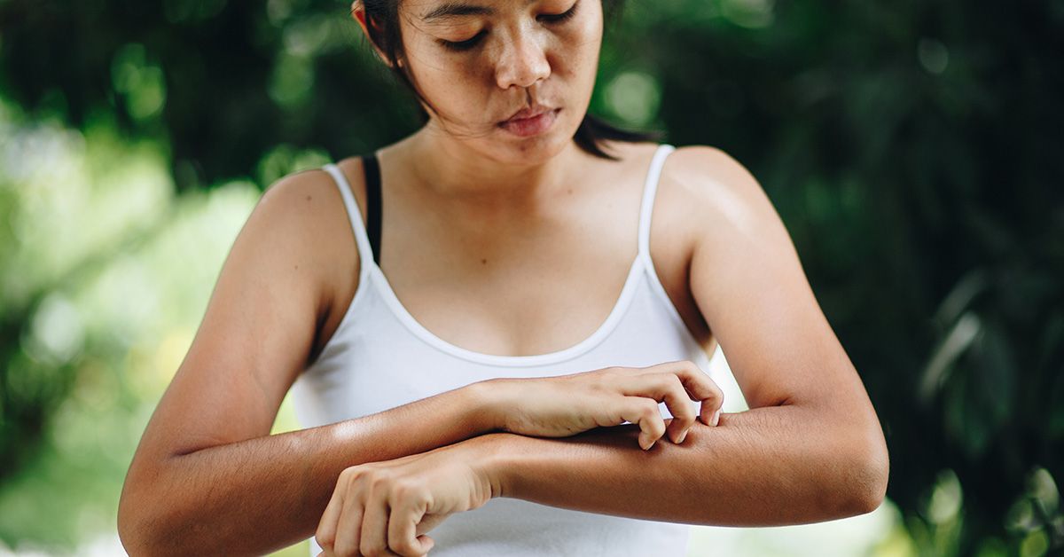 Is Psoriasis an Autoimmune Disease? Risk of Other Conditions, More