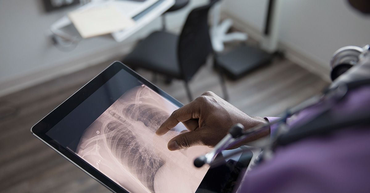 Stage 2 Lung Cancer: Types, Symptoms & Diagnosis