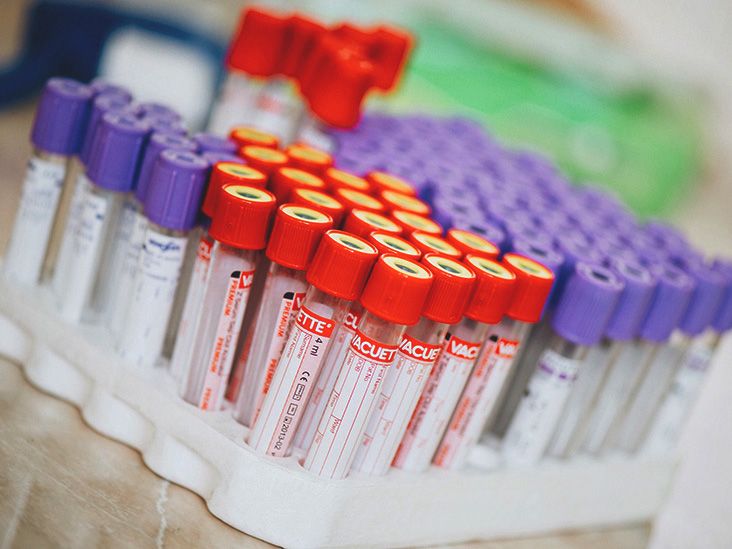 M Protein (Myeloma Protein): Spike, Monoclonal, in Blood, More