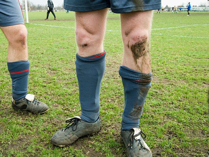 Unhappy Triad, Blown Knee: Symptoms, Causes, Treatment, Recovery