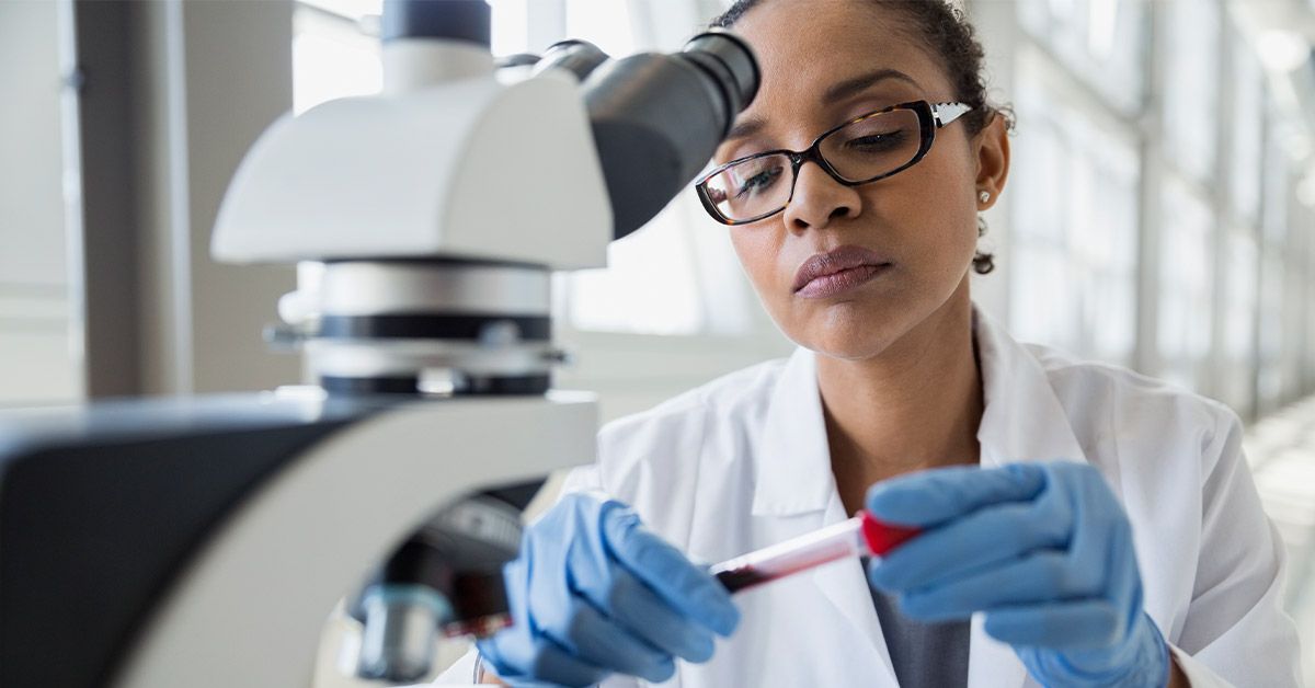 High Creatinine Levels: Test, Causes, Symptoms