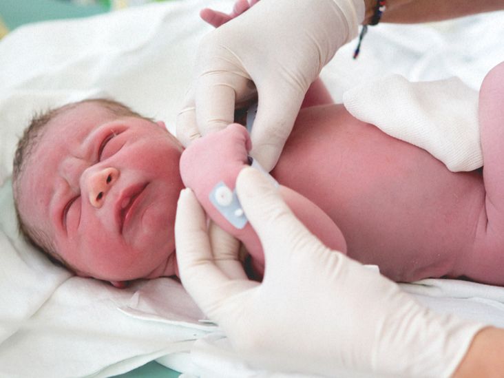 Apgar Score: Chart, Definition, Normal, Baby, and More