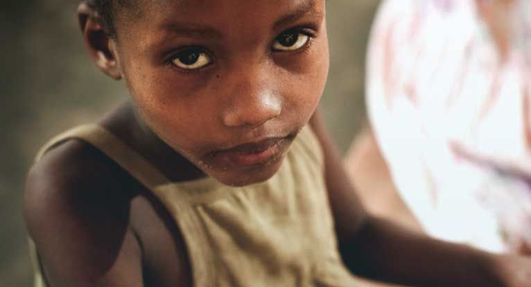 Kwashiorkor and Marasmus: What's the Difference?