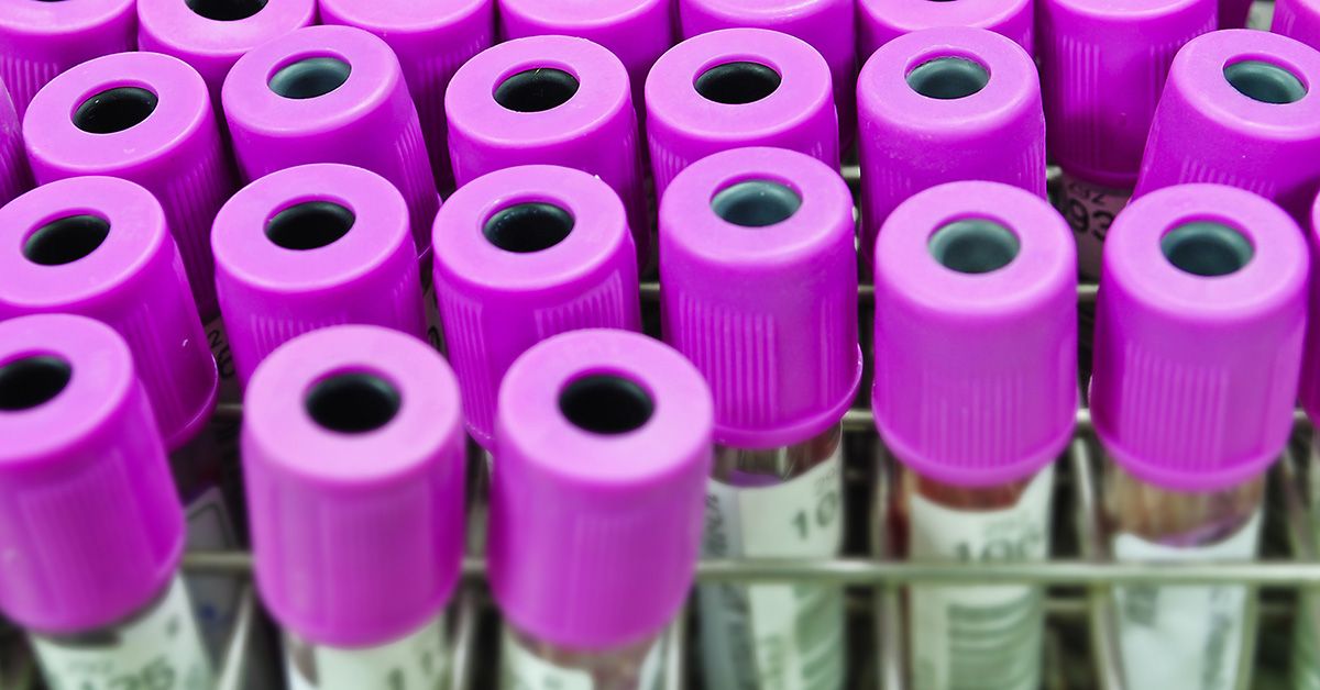 How Long Does It Take for a STD to Show Up? Incubation Periods