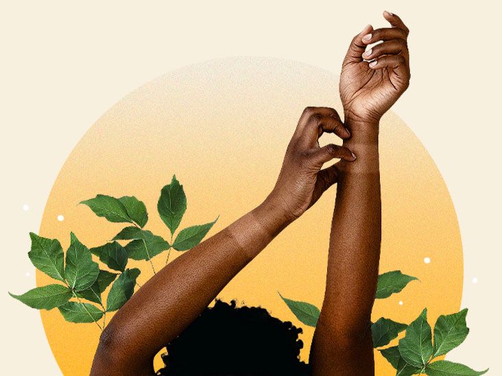 How to Identify Poison Ivy: In Spring, Summer, Fall & Winter