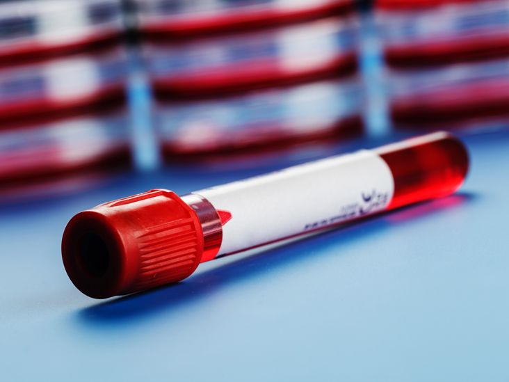 FTA-ABS Blood Test: Purpose, Procedure, and Results