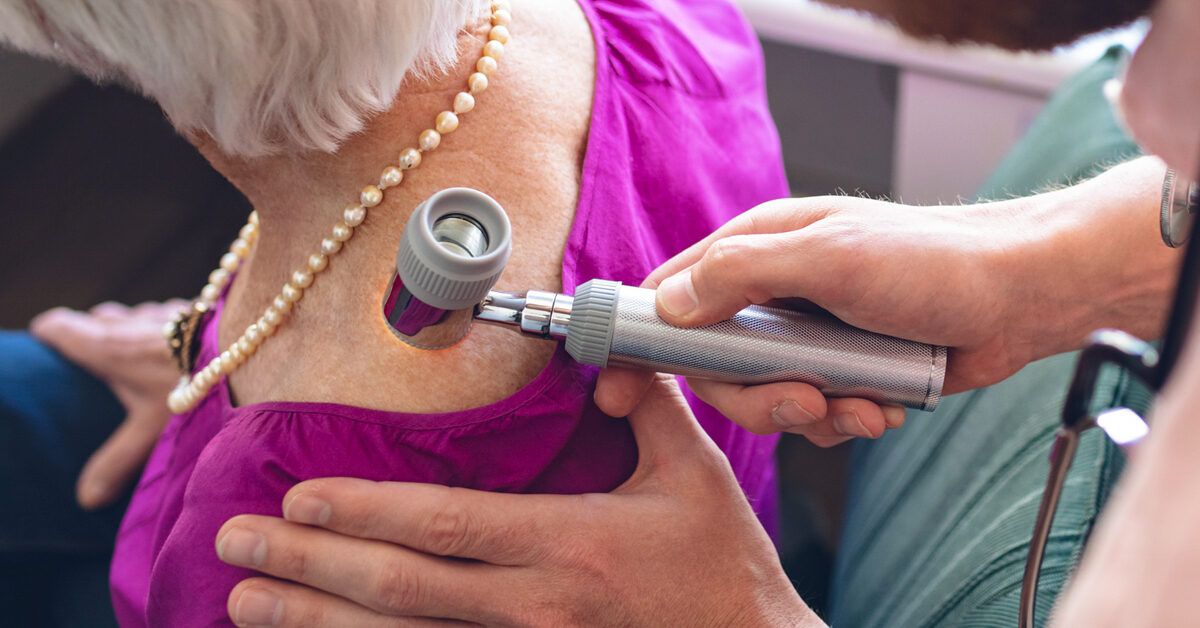 Squamous Cell Carcinoma: Pictures, Symptoms, and More