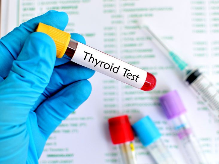 TSH (Thyroid-Stimulating Hormone) Test
