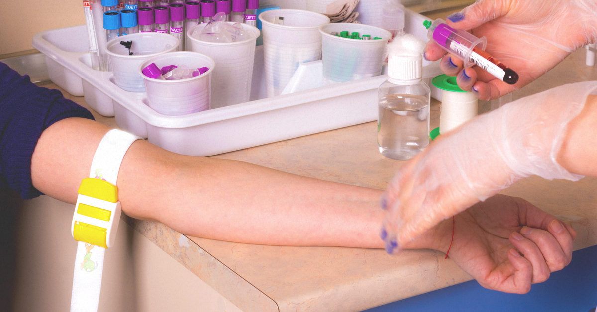 Blood Test for Fibromyalgia: What You Need to Know