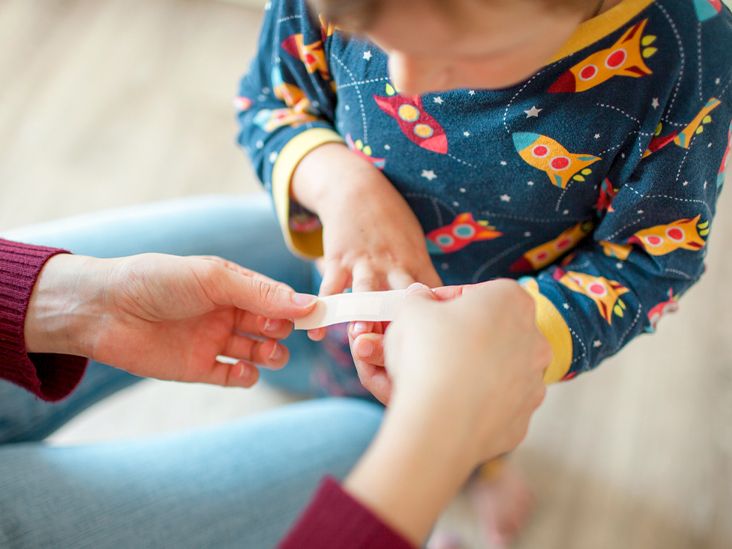 Allergic to Band-Aids and Other Bandages? Treatment and Alternatives