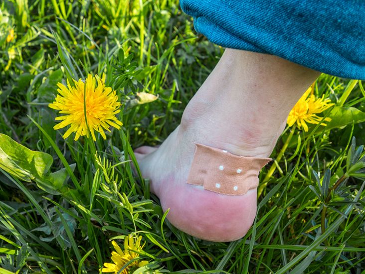 Crohn's Disease and Skin Issues: Rashes and More