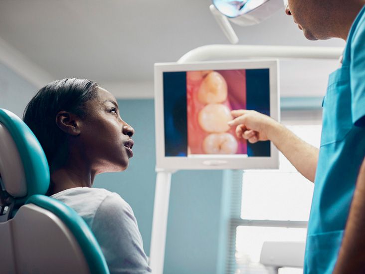 Do Tooth Worms Exist? Myths Debunked, and Causes of Decay