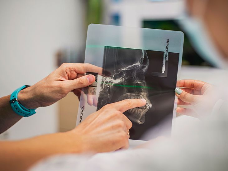 Jaw Cracking Causes, Treatments, and When to See a Doctor