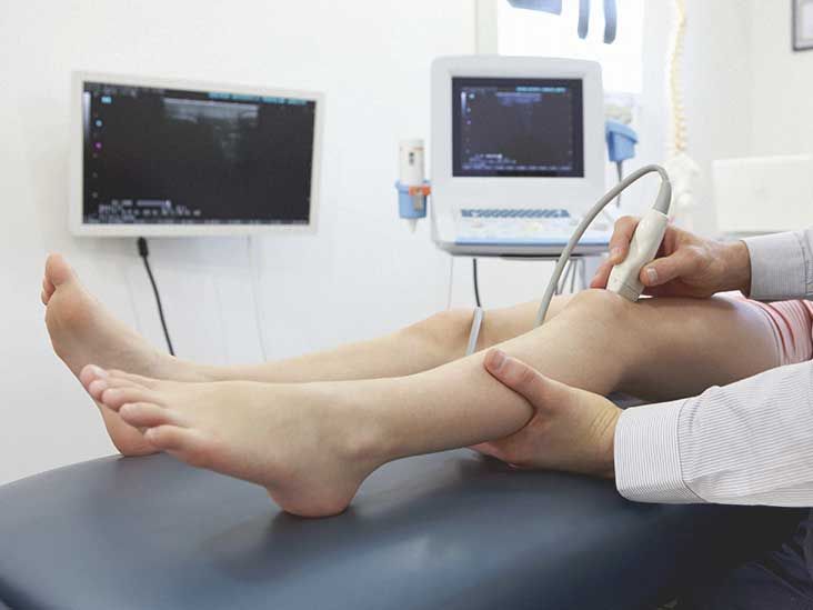 Tendonosis: Symptoms, Treatment, and Recovery Time