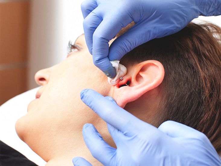 Infected Tragus Piercing: Symptoms, Treatment, and More