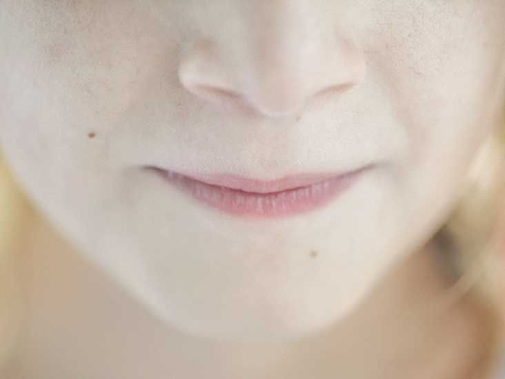 Mole Disappears: What Now?