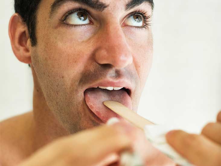Is Thrush Contagious? Prevention, Complications and More