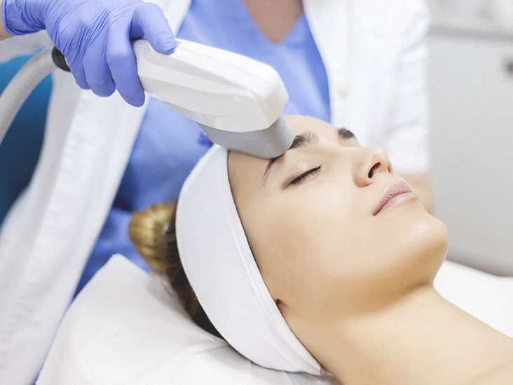 IPL Treatment: Cost, Procedure, and More
