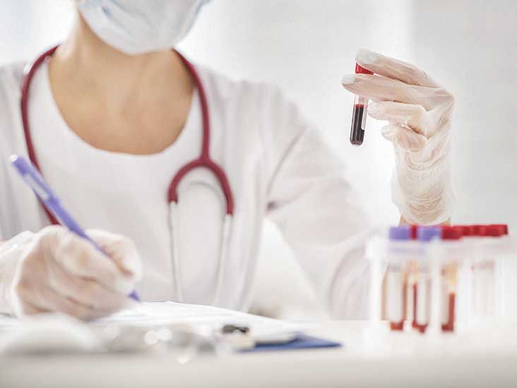 SGOT Test: What the Results Mean