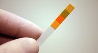 Uric Acid Test (Blood Analysis)