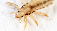What Are Lice, and Where Do They Come From?