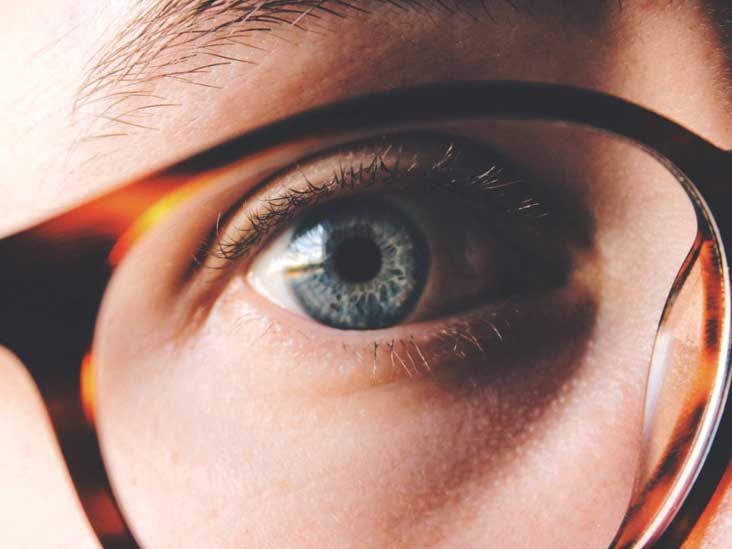 Fuchs’ Dystrophy: Treatments, Symptoms, and Stages