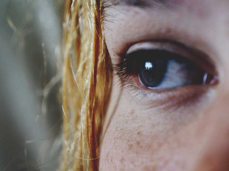 Exotropia: Symptoms, Management, and More