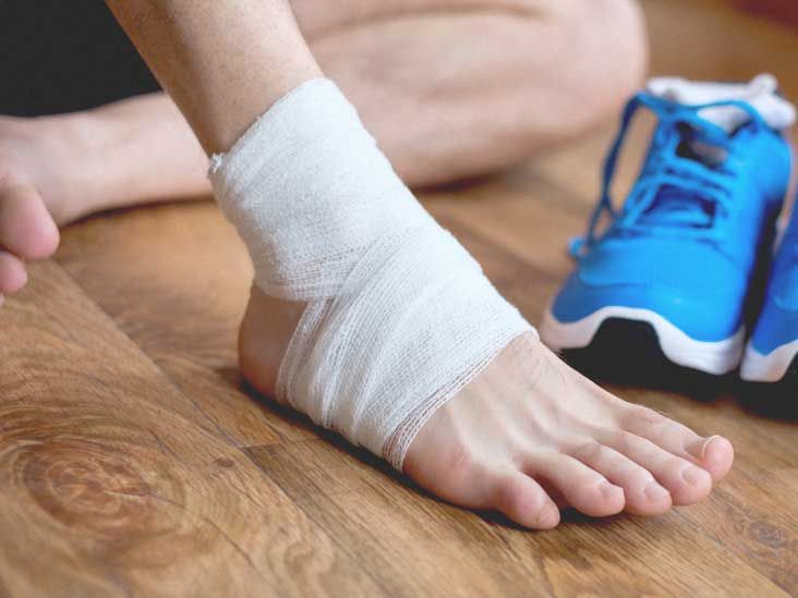 Cuboid Syndrome: Treatment and Recovery