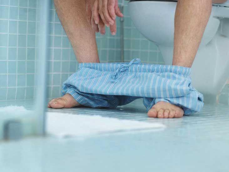Caliectasis: Symptoms, Causes, and Treatment