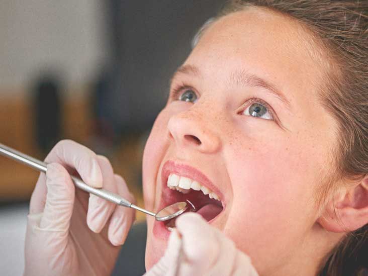 Dientes negros: Esmalte, caries, manchas y cómo se trata