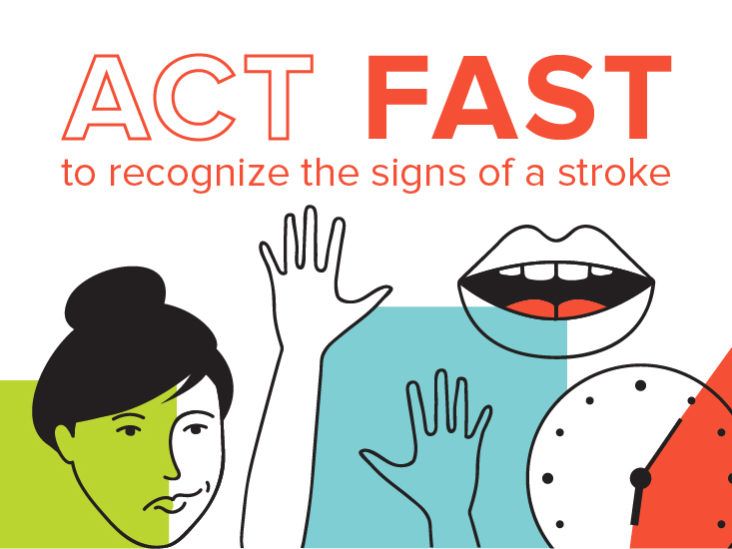 Fast Stroke