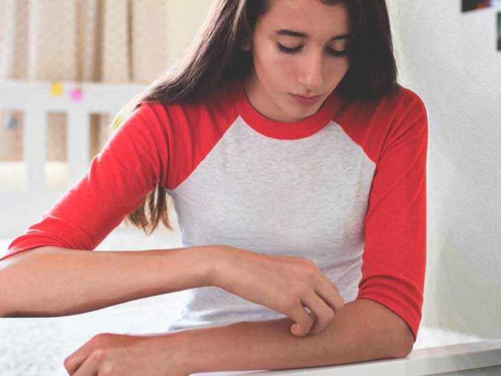 Basophilia: Definition, Symptoms, and Causes