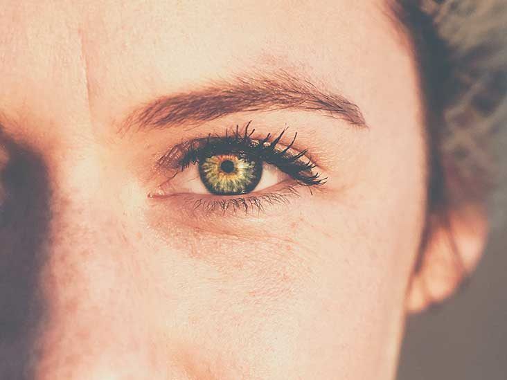 Triple Eyelid On One Eye