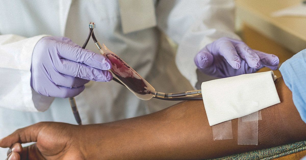 G6PD Test: Purpose, Procedure, and Follow-Up