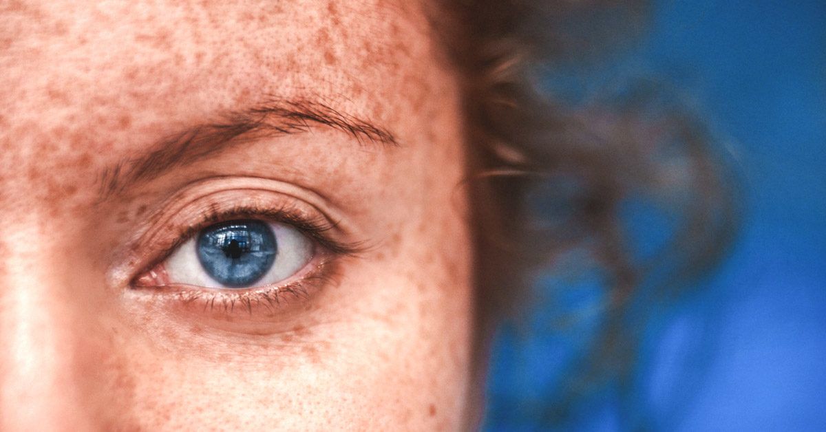 Exophoria: Definition, Treatment, and How It Compares to Exotropia