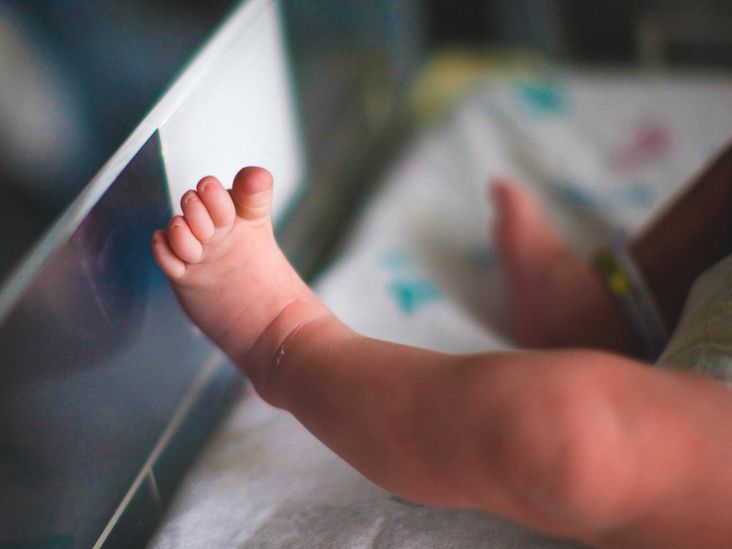 Cyclopia: Definition, Life Expectancy, and Causes