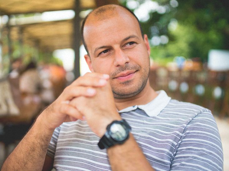 Scalp Reduction Surgery: Requirements, Procedure, Recovery, and Risks