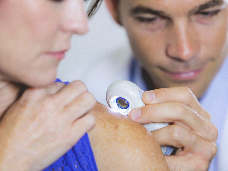 Skin Neoplasm: Malignant, Benign, Uncertain Behavior, and Cancer Risk