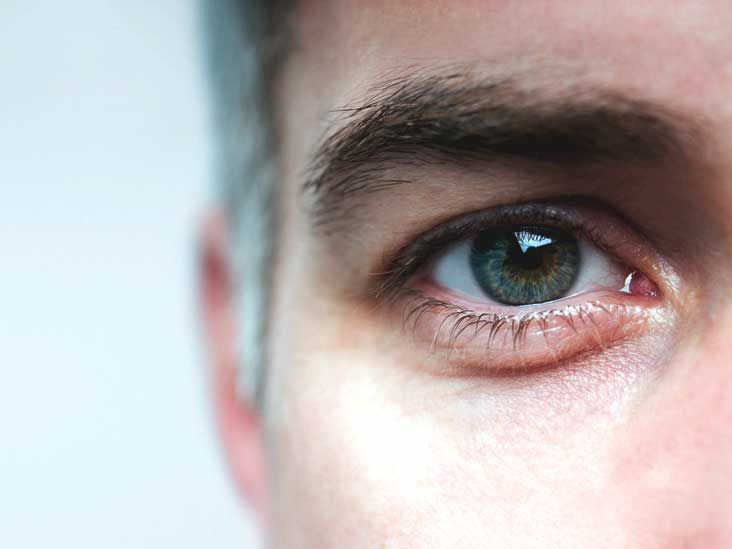 Mydriasis: Causes, Treatment, and More