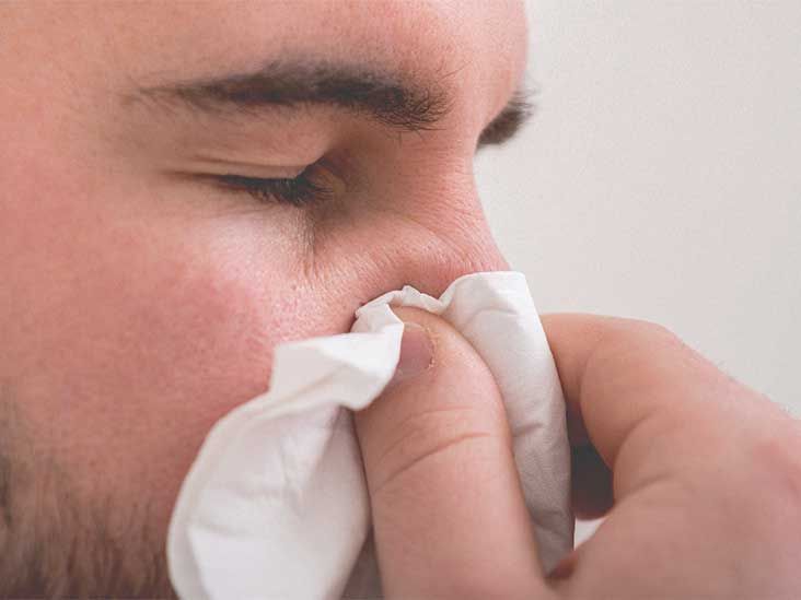 Posterior Nosebleed: Causes and Treatments