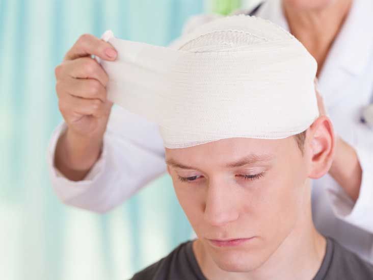 Battle Sign: Pictures, Causes, Treatment, and More