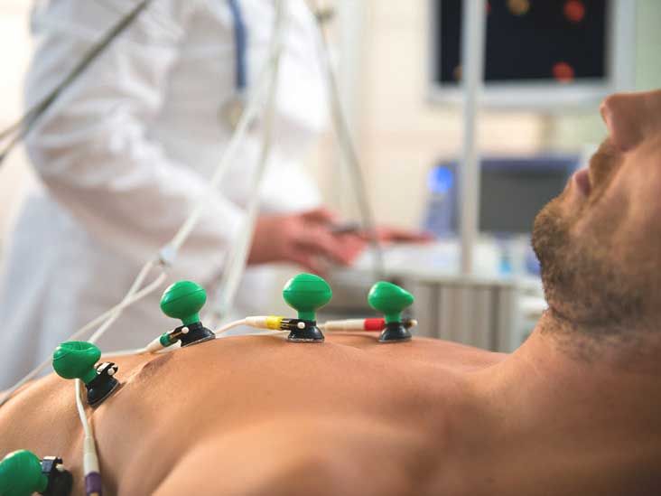 Bigeminy: Symptoms, Causes, and Treatment