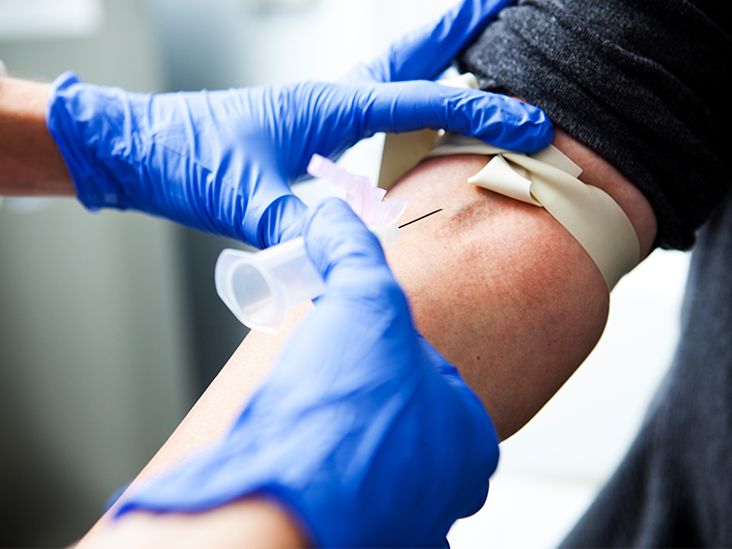 Lactate Dehydrogenase Test: Types, Procedure, and Results