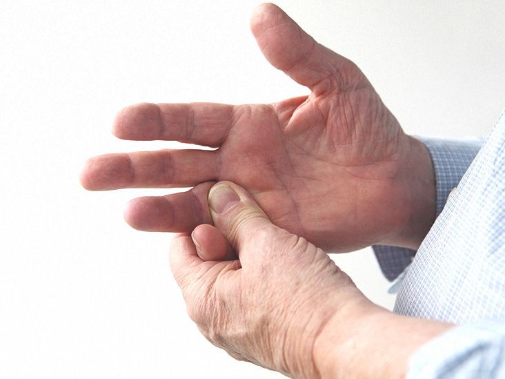 Sprained Finger: Symptoms, Home Treatments, and More