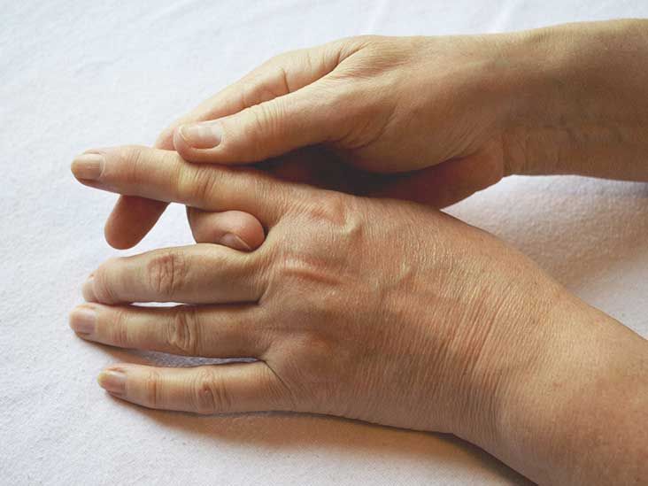 Trigger Finger Surgery: Recovery, Procedure, and More