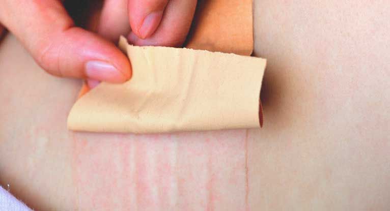 Transdermal Patches: How to Apply Them