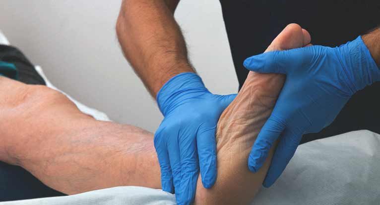 Jones Fracture: Symptoms, Treatment, and More