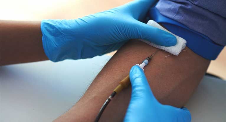 Plasmapheresis: Definition and Patient Education